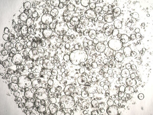 3dGRO™ Transcending Colon Intestinal Organoids, Age 36 (Prep ht-213-CT ...